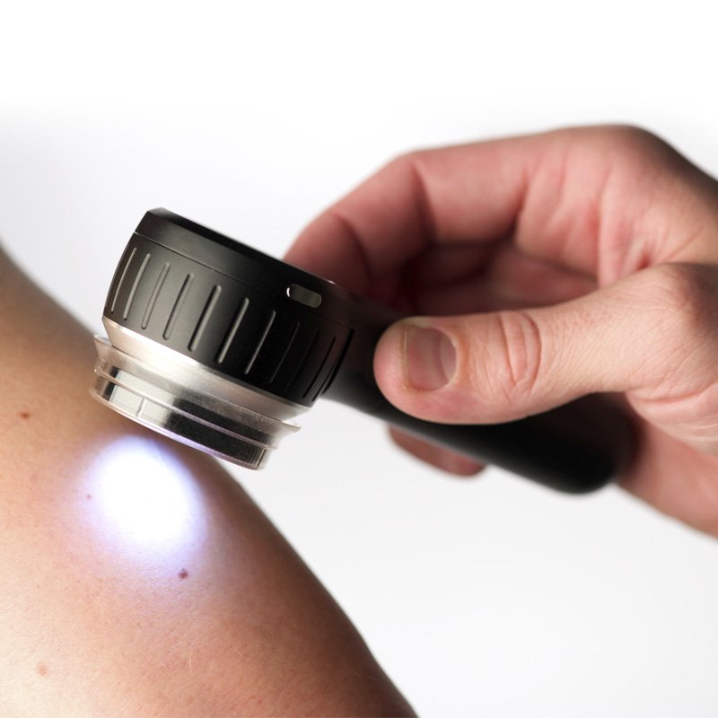 La Dermatoscopia - Il Quadrilatero - Poliambulatorio specialistico ...